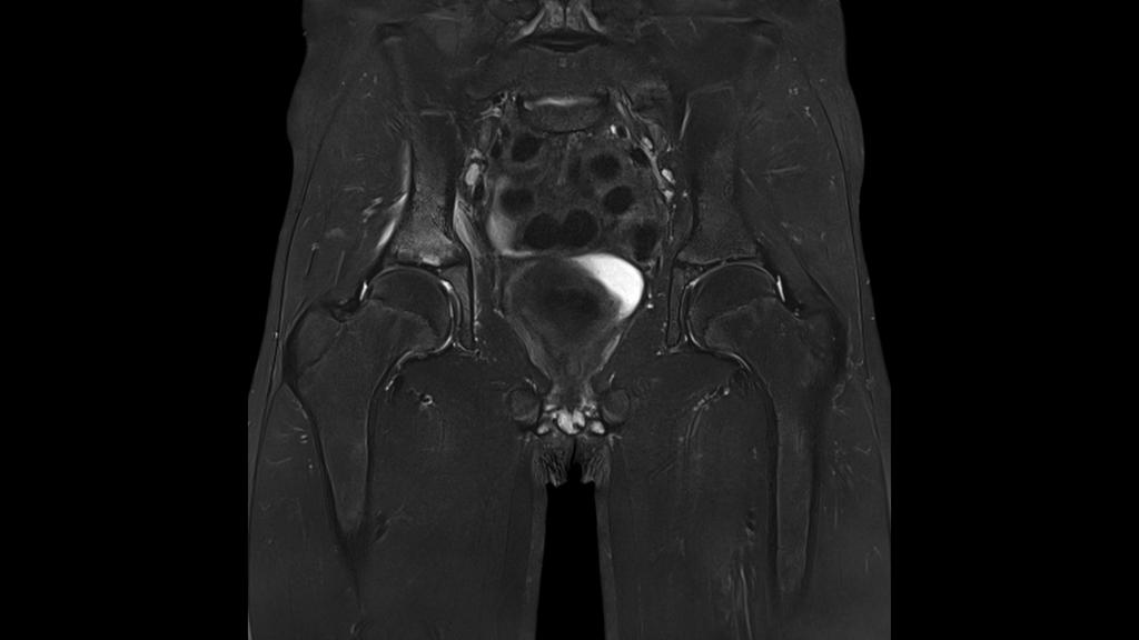 Pediatric MRI - Siemens Healthineers