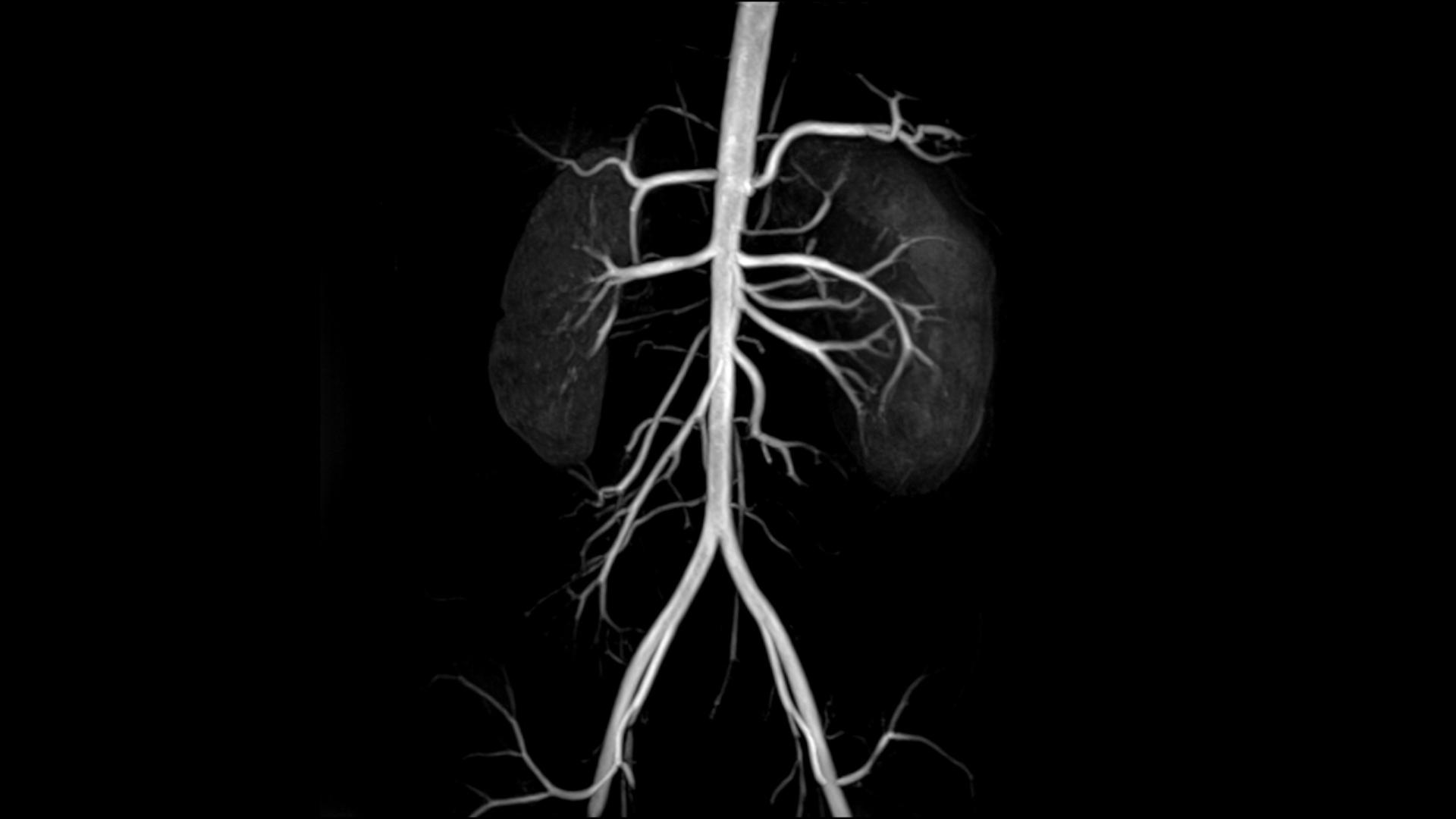 Pediatric MRI - Siemens Healthineers