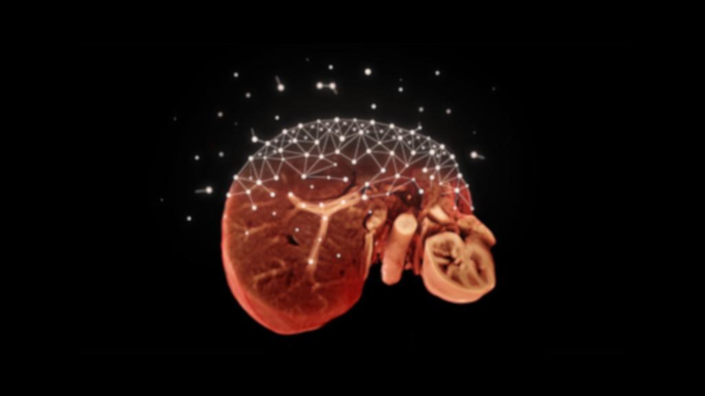 Compressed Sensing - Siemens Healthineers