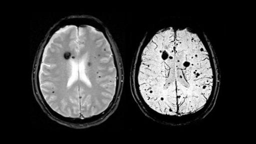 MR Neuro Imaging - MRI Neurology - Siemens Healthineers Schweiz