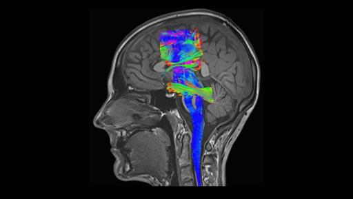 Neurology MRI - Siemens Healthineers