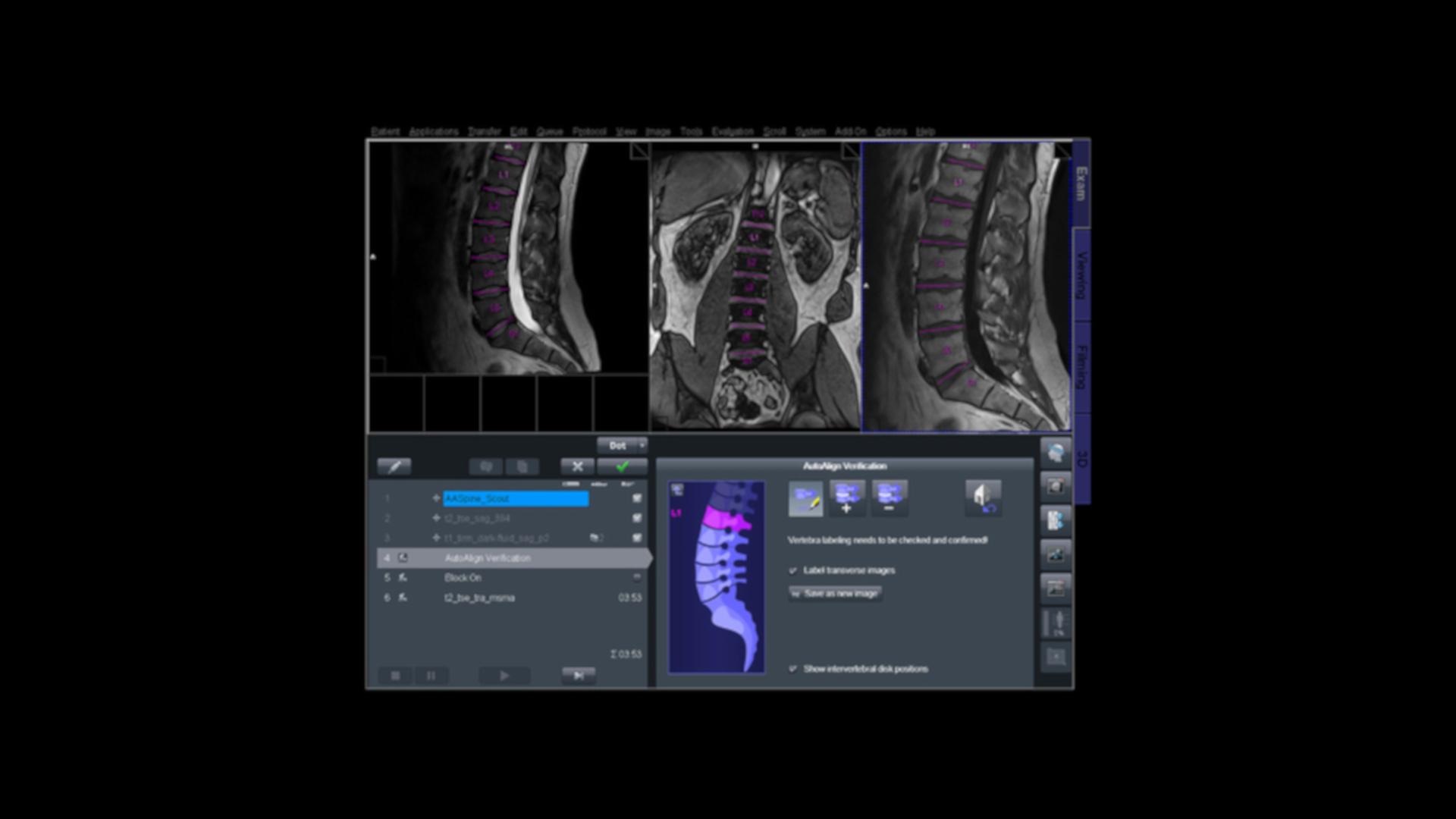MR Neuro Imaging - MRI Neurology - Siemens Healthineers