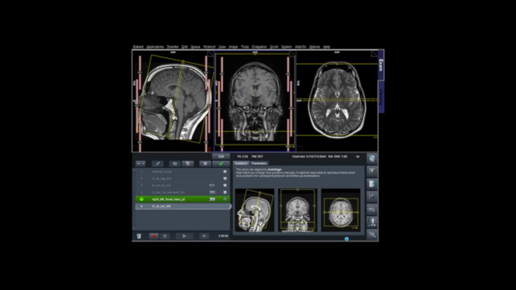 MR Neuro Imaging - MRI Neurology - Siemens Healthineers