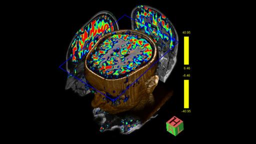 Neurology MRI - Siemens Healthineers