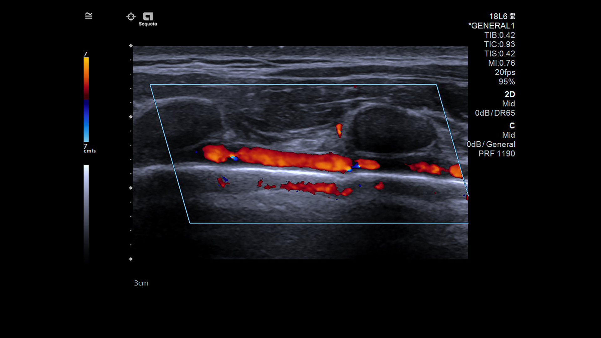 White Paper: Lung Ultrasound in Patients with Coronavirus COVID-19 ...