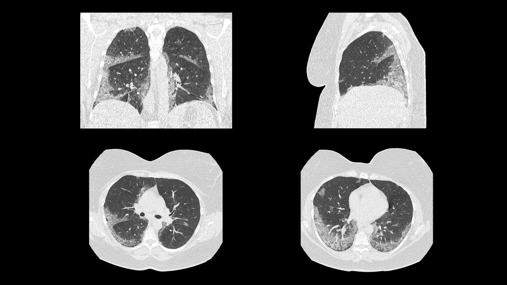 Our response to the COVID-19 pandemic - Siemens Healthineers Canada