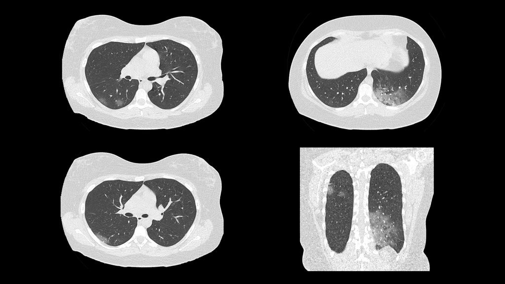 Our response to the COVID-19 pandemic - Siemens Healthineers Canada