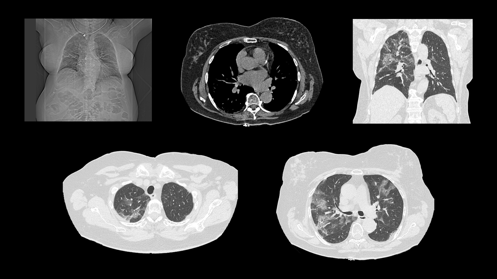 Our response to the COVID-19 pandemic - Siemens Healthineers