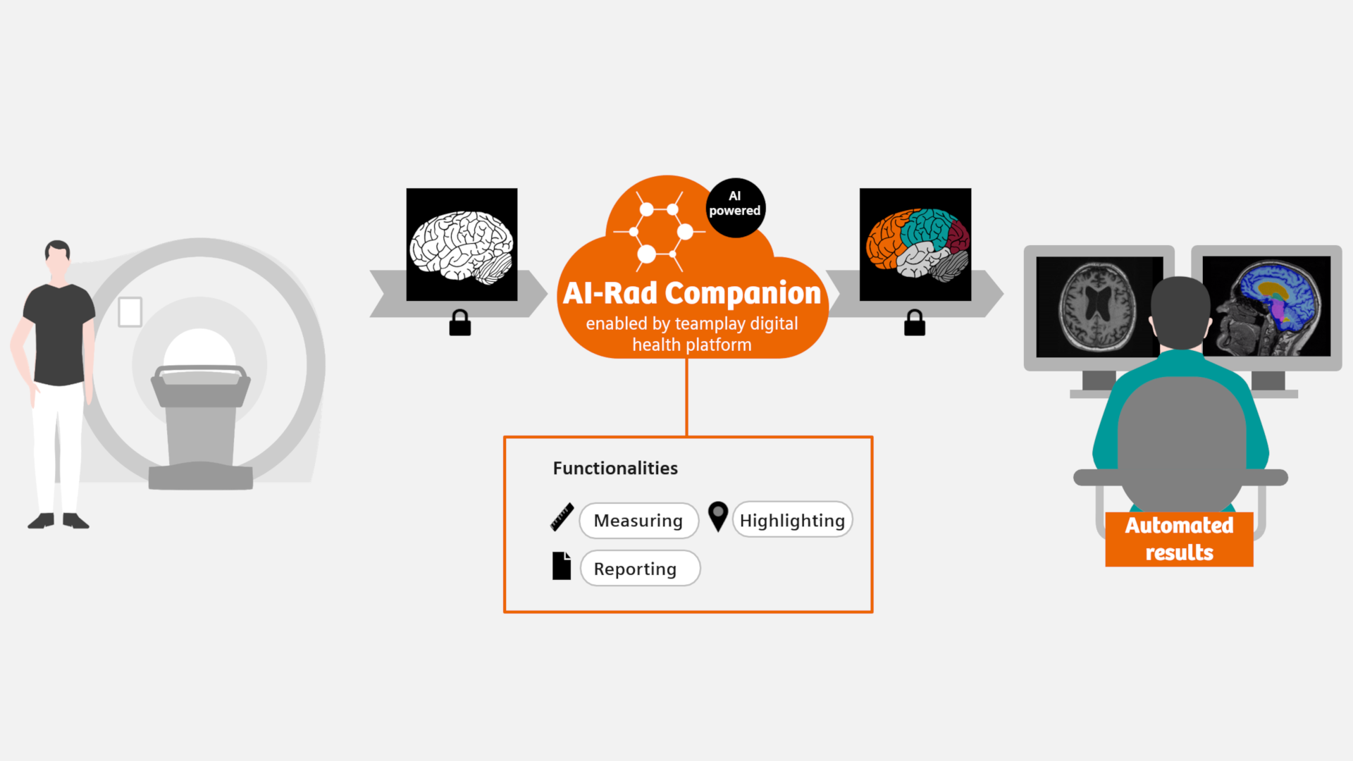 AI-Rad Companion - Siemens Healthineers Latinoamérica