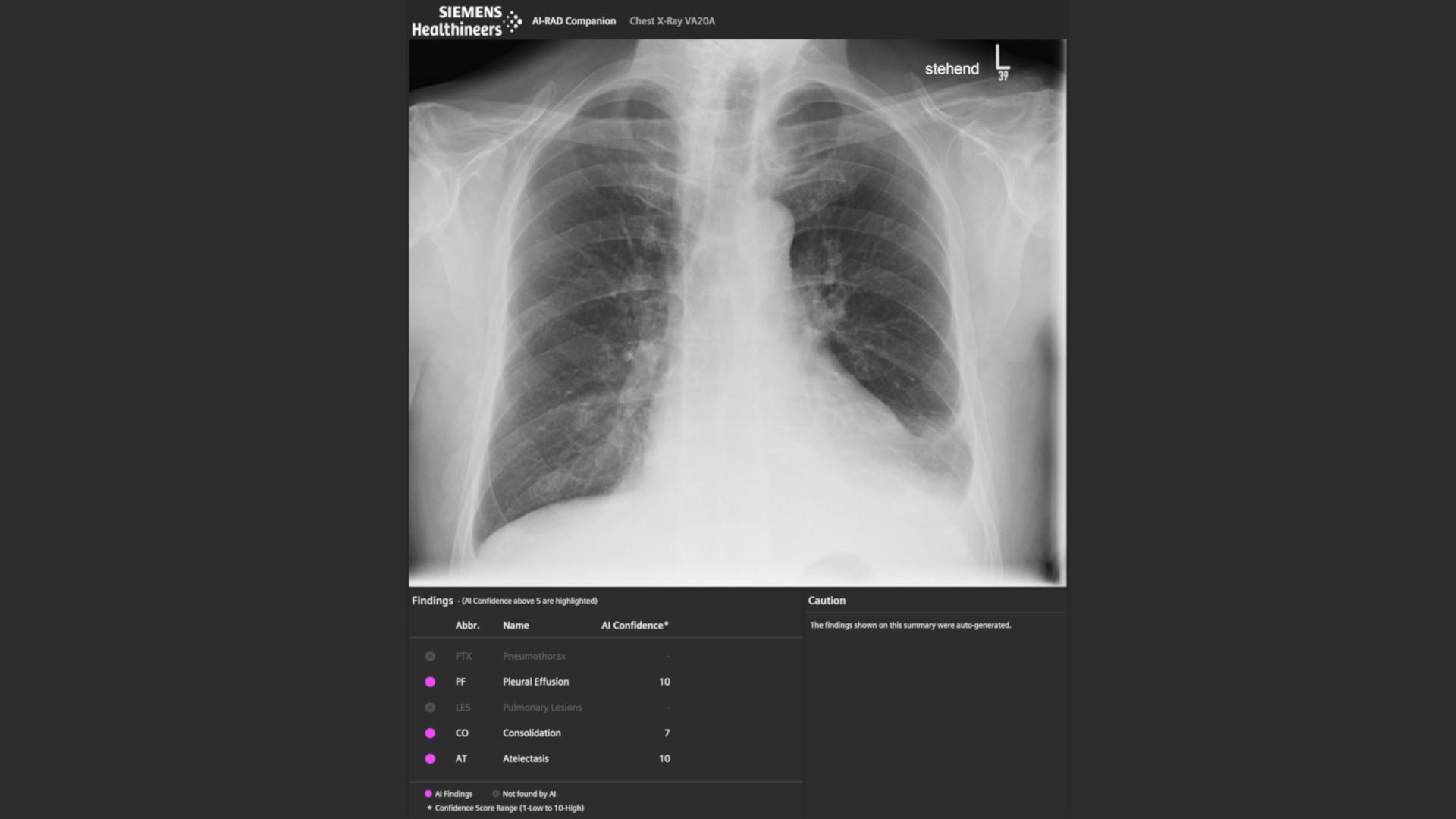 AI-Rad Companion - Siemens Healthineers Brasil