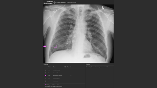 AI-Rad Companion - Siemens Healthineers Brasil
