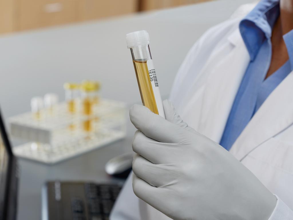 Urinalysis Products - Siemens Healthineers