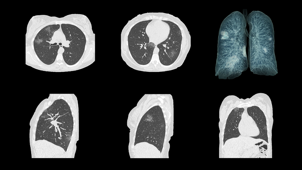 Our response to the COVID-19 pandemic - Siemens Healthineers Canada