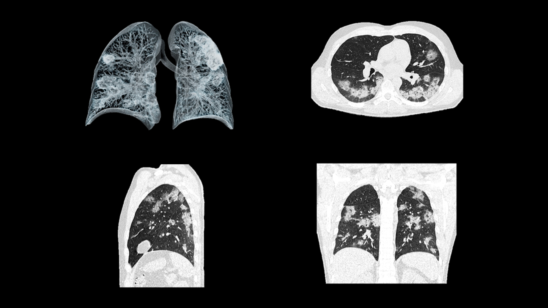 Our response to the COVID-19 pandemic - Siemens Healthineers