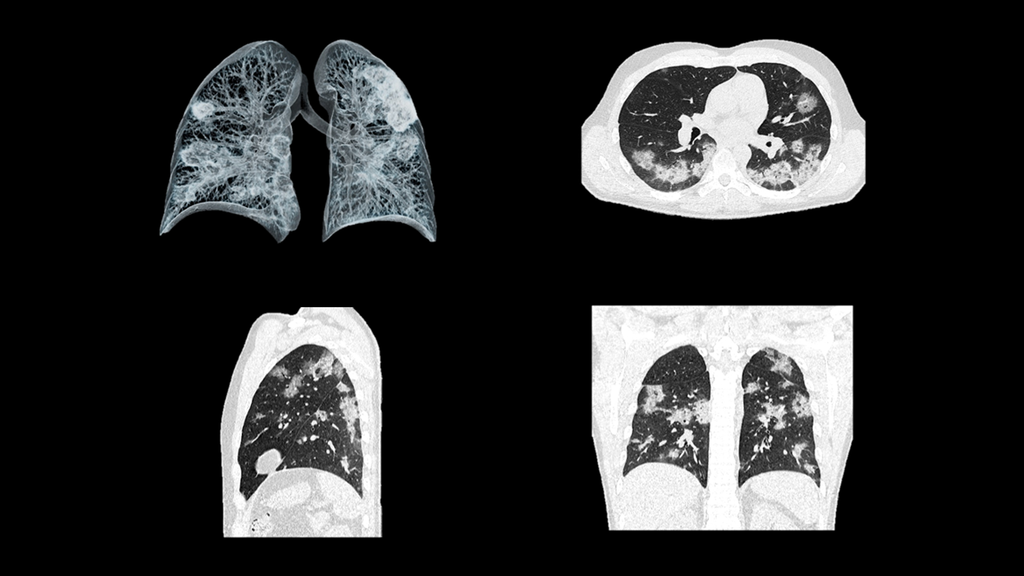 Our response to the COVID-19 pandemic - Siemens Healthineers Canada