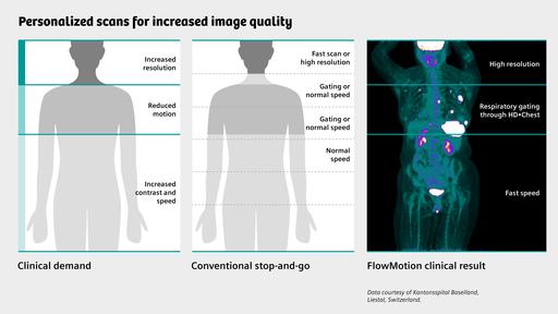 FlowMotion AI: An AIDAN Technology - Siemens Healthineers USA