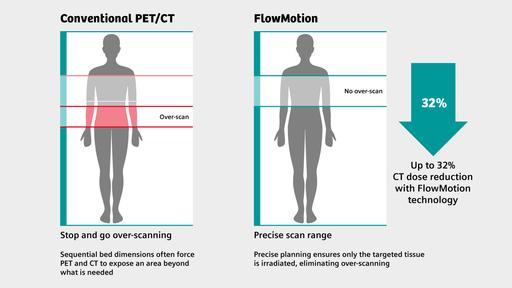 FlowMotion AI: An AIDAN Technology - Siemens Healthineers USA