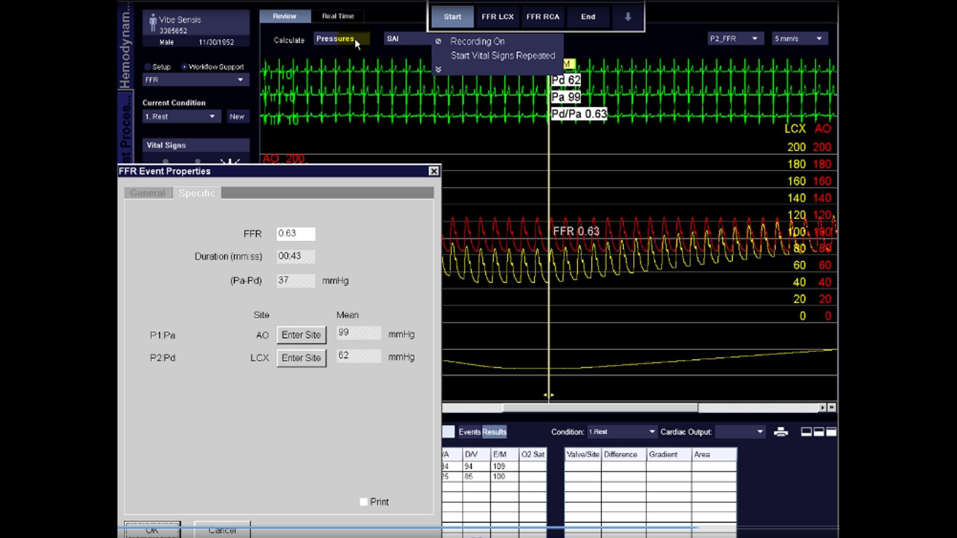 Rethink FFR Assessment for Every Patient - Siemens Healthineers USA