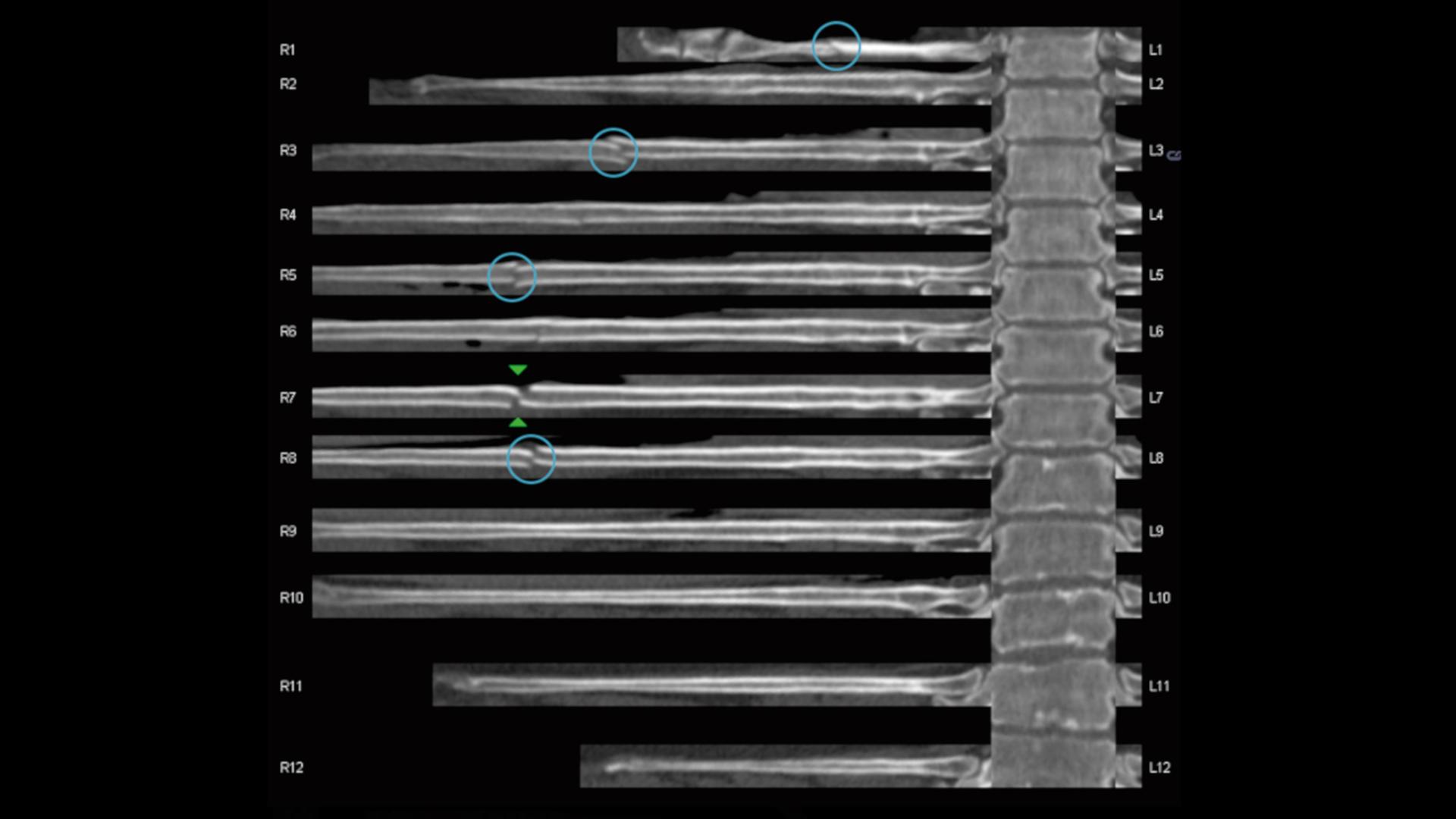 Acute Care - Siemens Healthineers