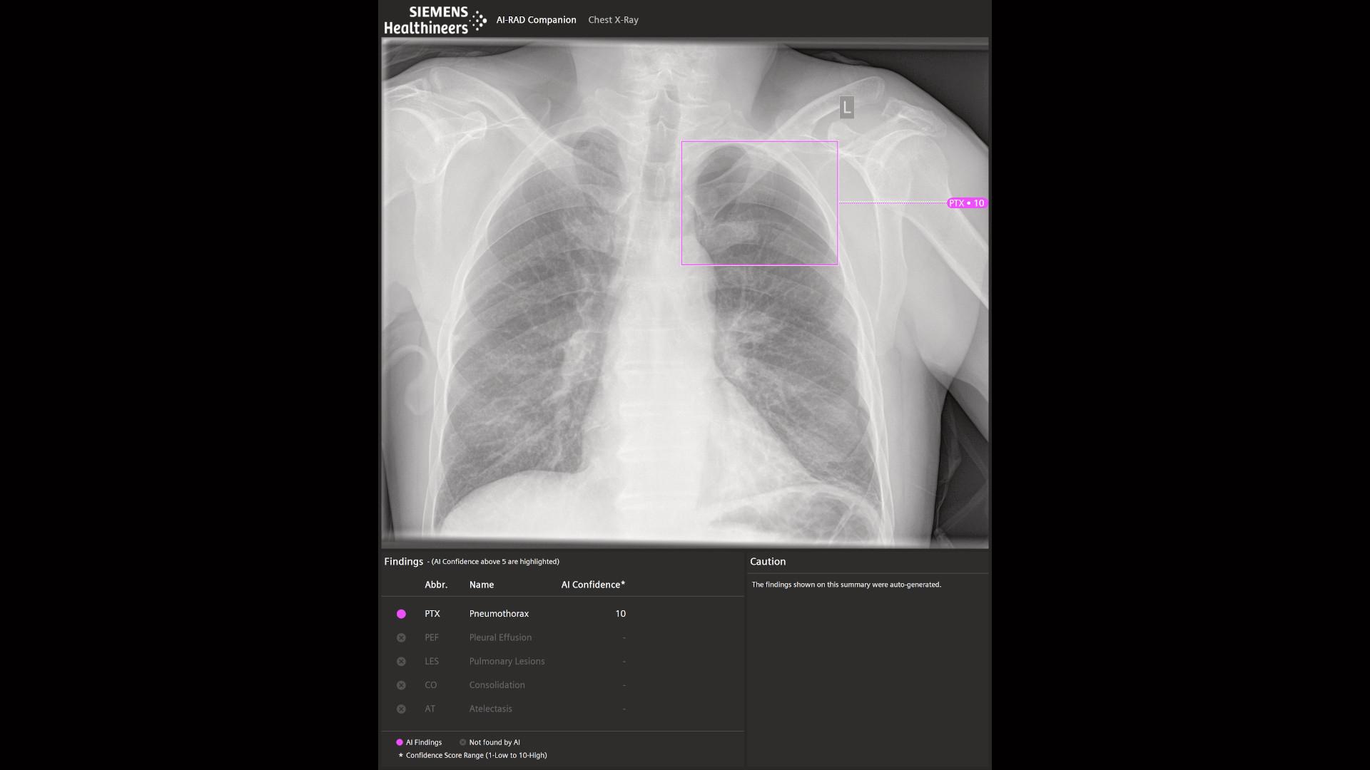 Siemens Healthineers further expanding AI portfolio in the field of ...
