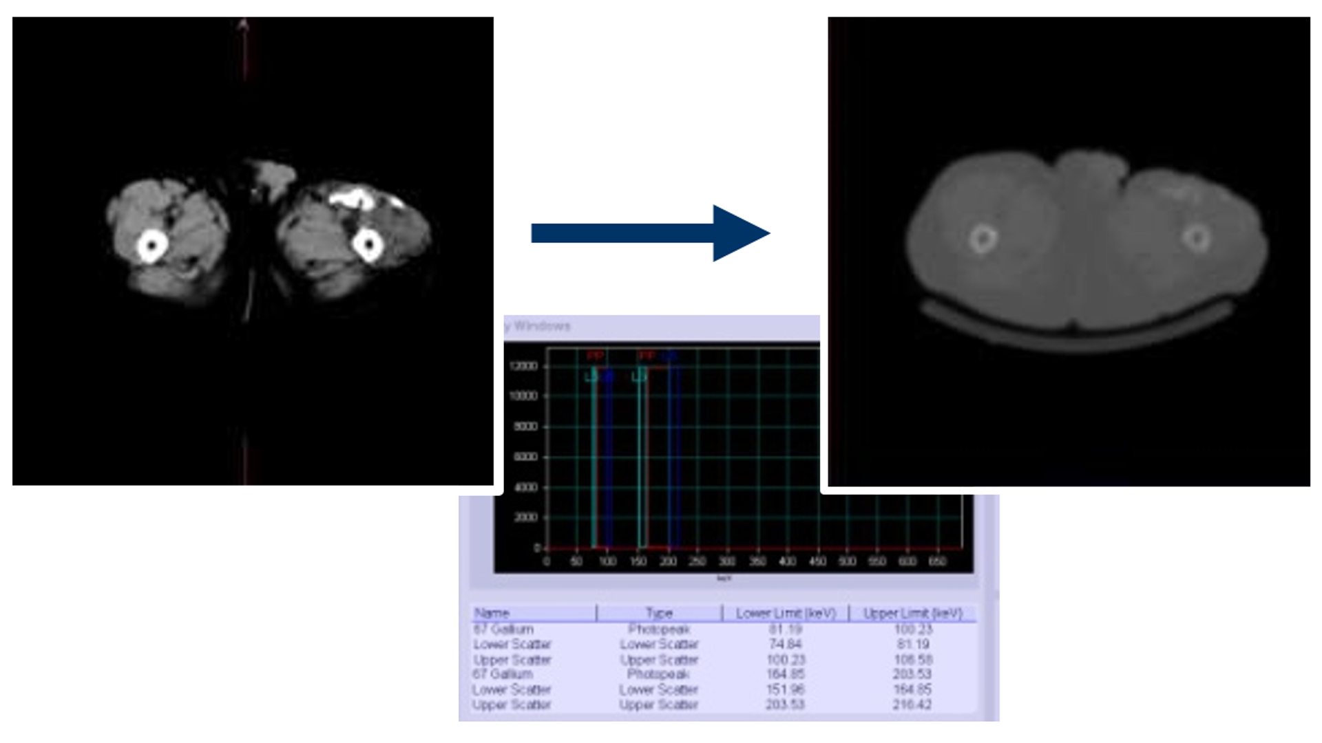 Advanced SPECT/CT Reconstruction - Siemens Healthineers Japan