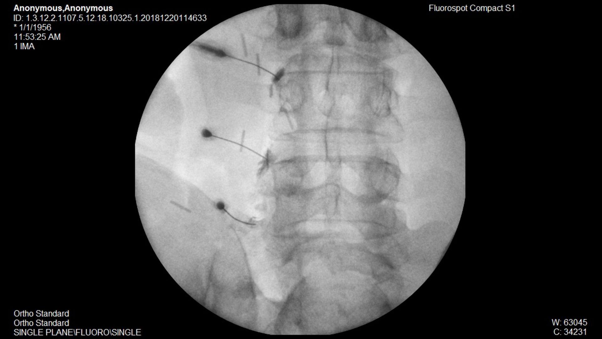 Pain Management Imaging - Siemens Healthineers USA