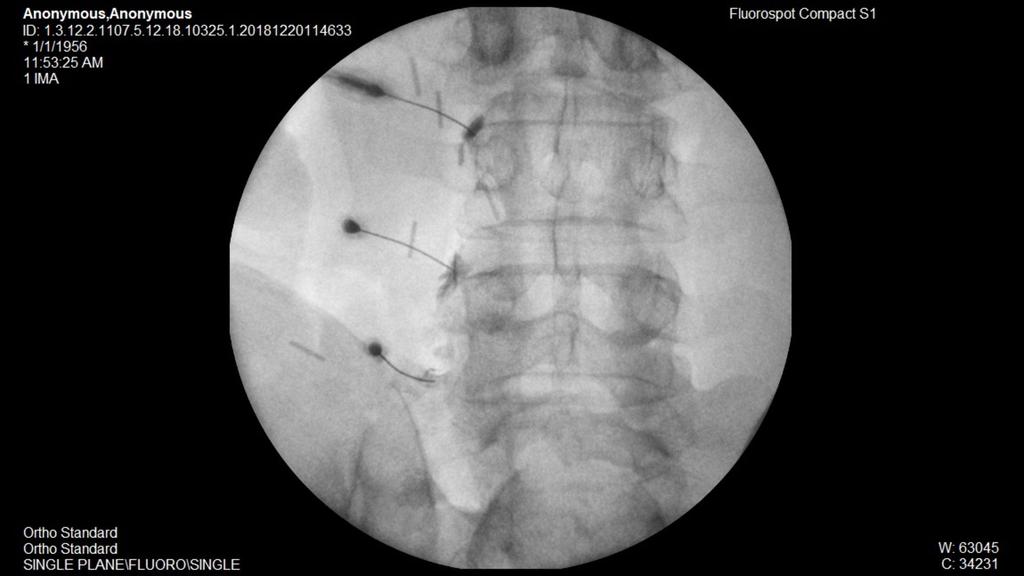 Pain Management Imaging - Siemens Healthineers USA