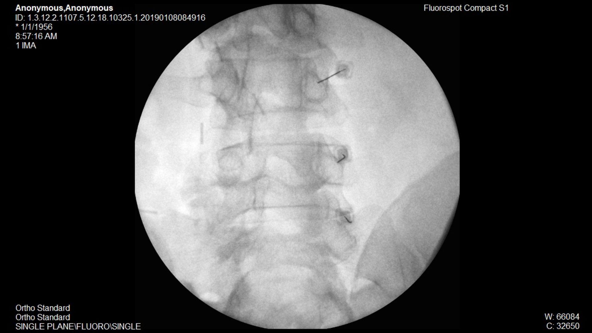 Pain Management Imaging - Siemens Healthineers USA