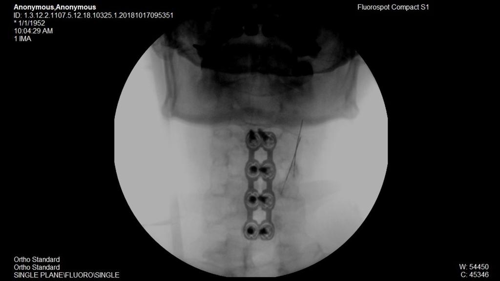Pain Management Imaging - Siemens Healthineers USA
