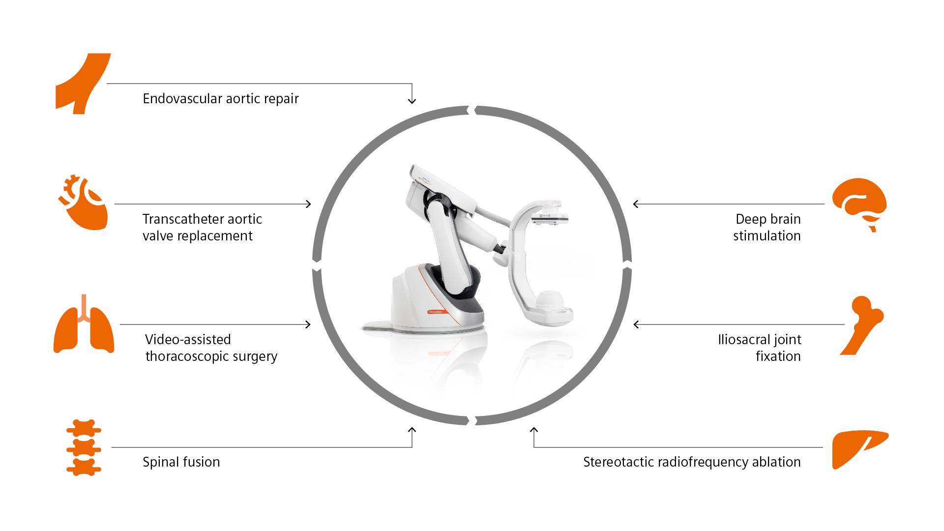 ARTIS pheno - Siemens Healthineers