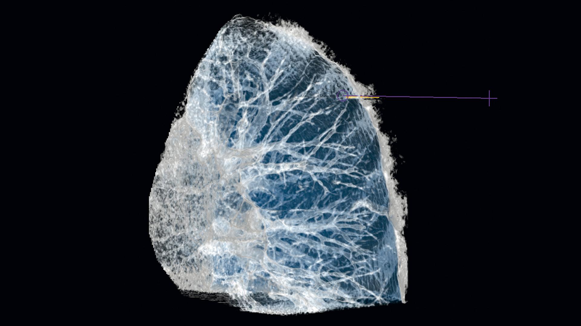 ARTIS pheno - Siemens Healthineers