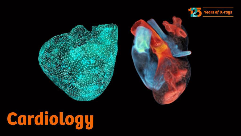 X-rays in Cardiology