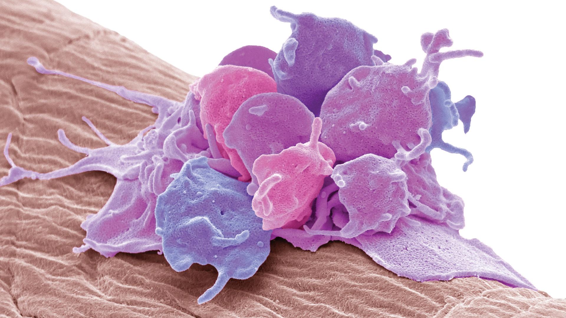 Qu’est-ce que l’hémostase ? - Siemens Healthineers France