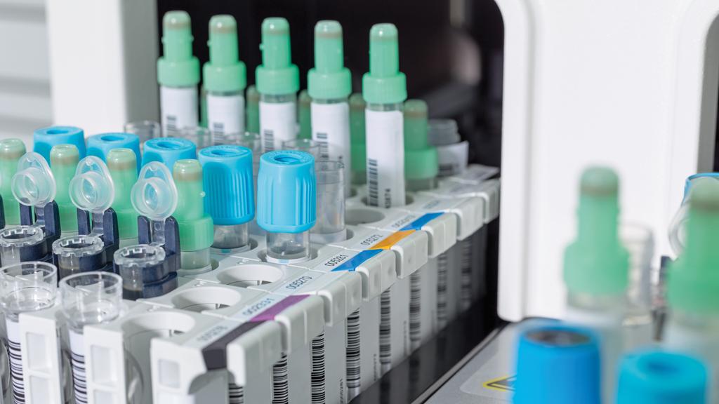 What is hemostasis? - Siemens Healthineers USA