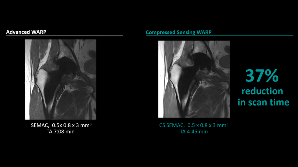 Compressed Sensing SEMAC