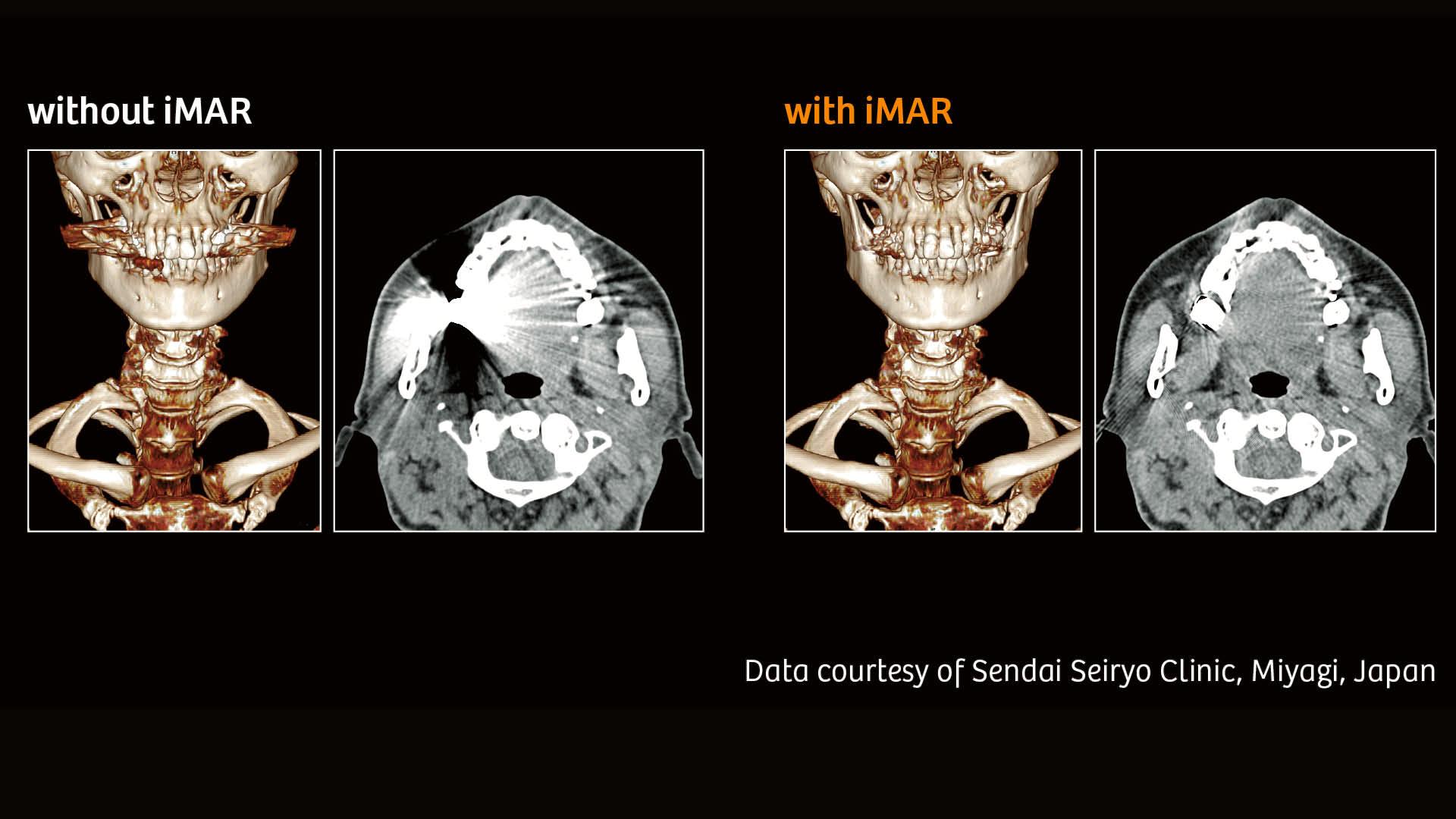 Biograph mCT - PET/CT - 分子イメージング - 核医学 - Siemens Healthineers Japan