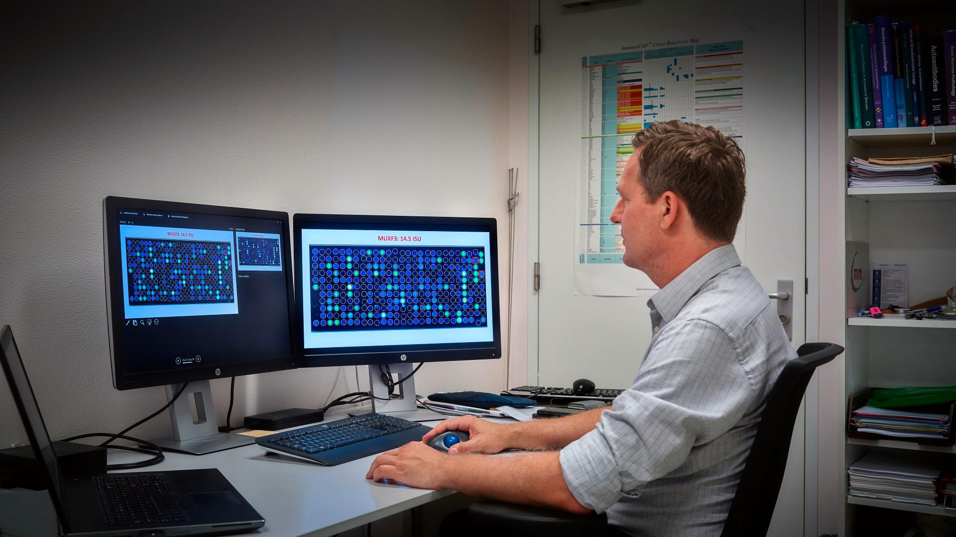 ALEX2 betekent evolutie in allergiediagnostiek Siemens Healthineers ...