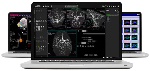 Virtuálny tréning medicínskych zákrokov – Smart Simulator - Siemens ...