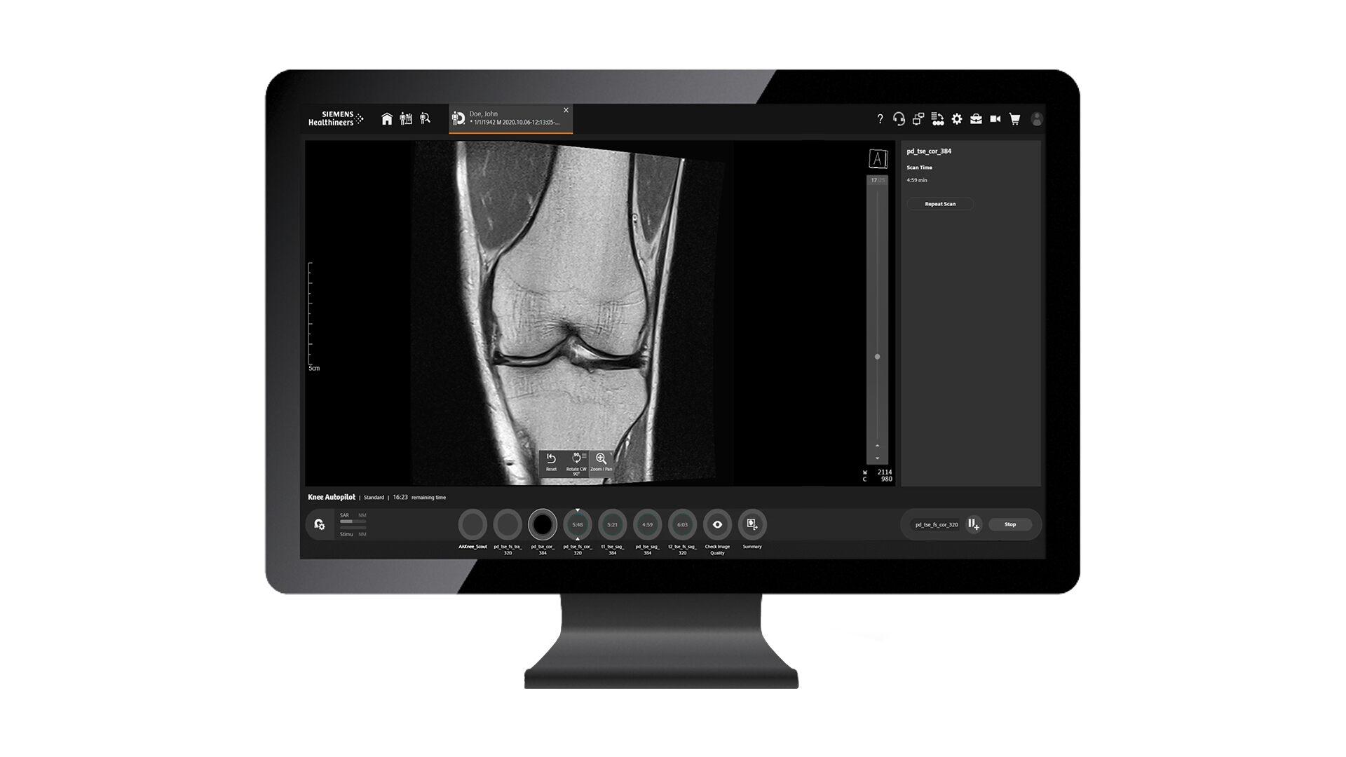 MAGNETOM Altea - Siemens Healthineers