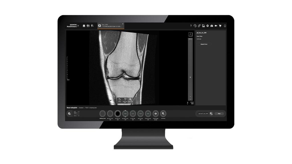 MAGNETOM Altea - Siemens Healthineers