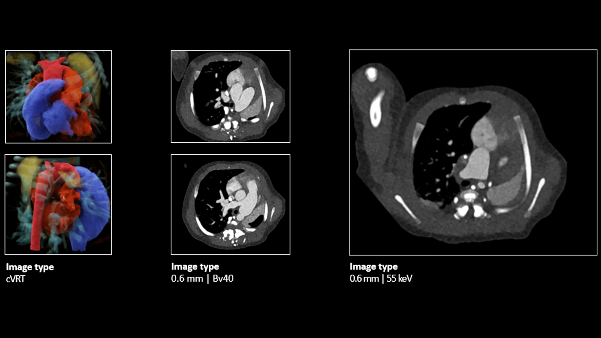 The Siemens Healthineers CT Imaging Chain - Siemens Healthineers
