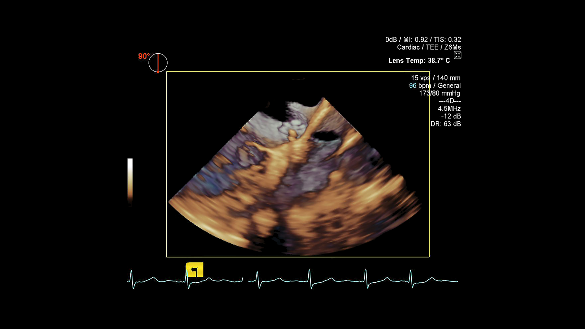 Cardiovascular Ultrasound | ACUSON SC2000 Ultrasound System - Siemens ...