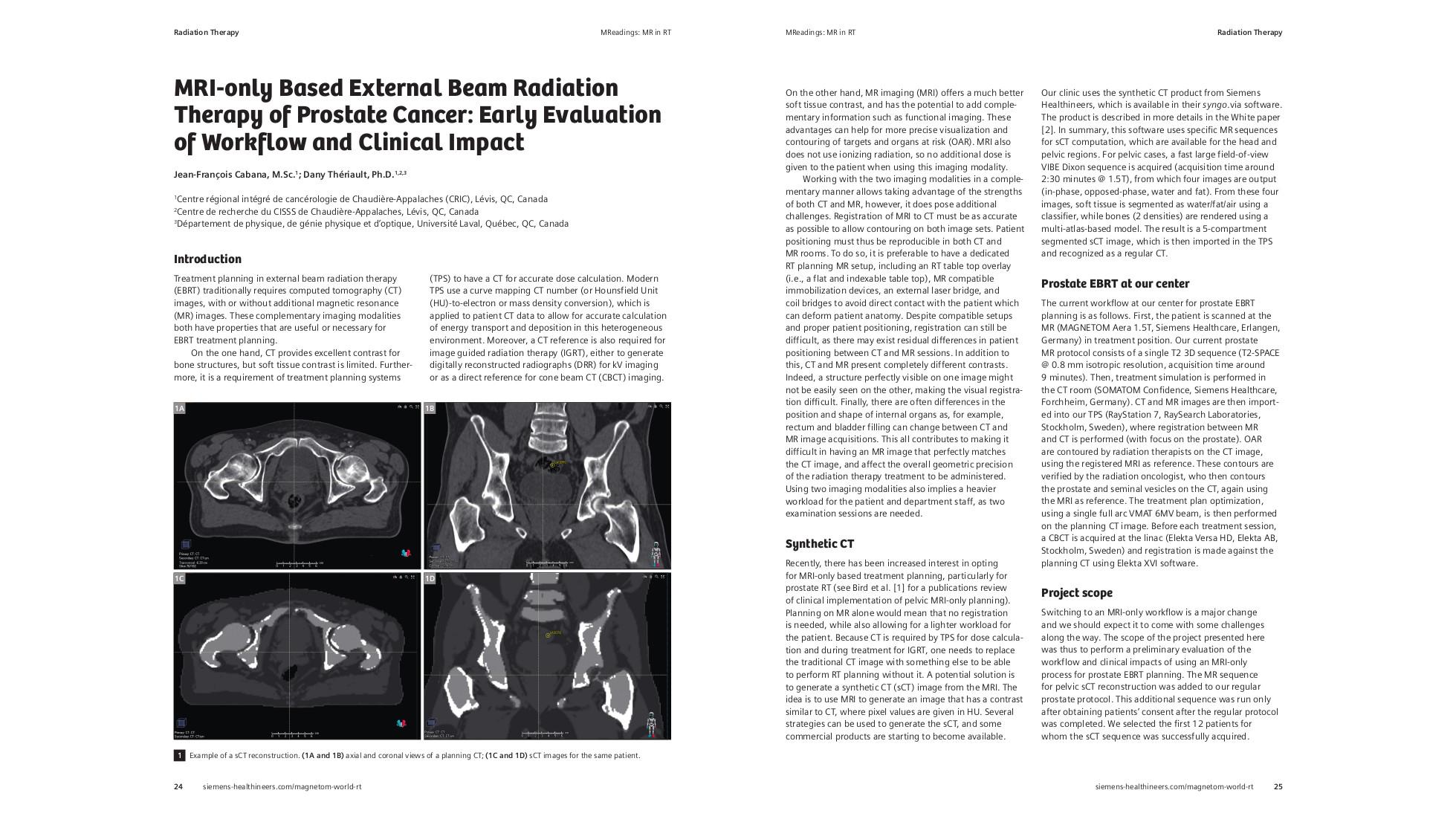 MRI for radiation therapy - Siemens Healthineers
