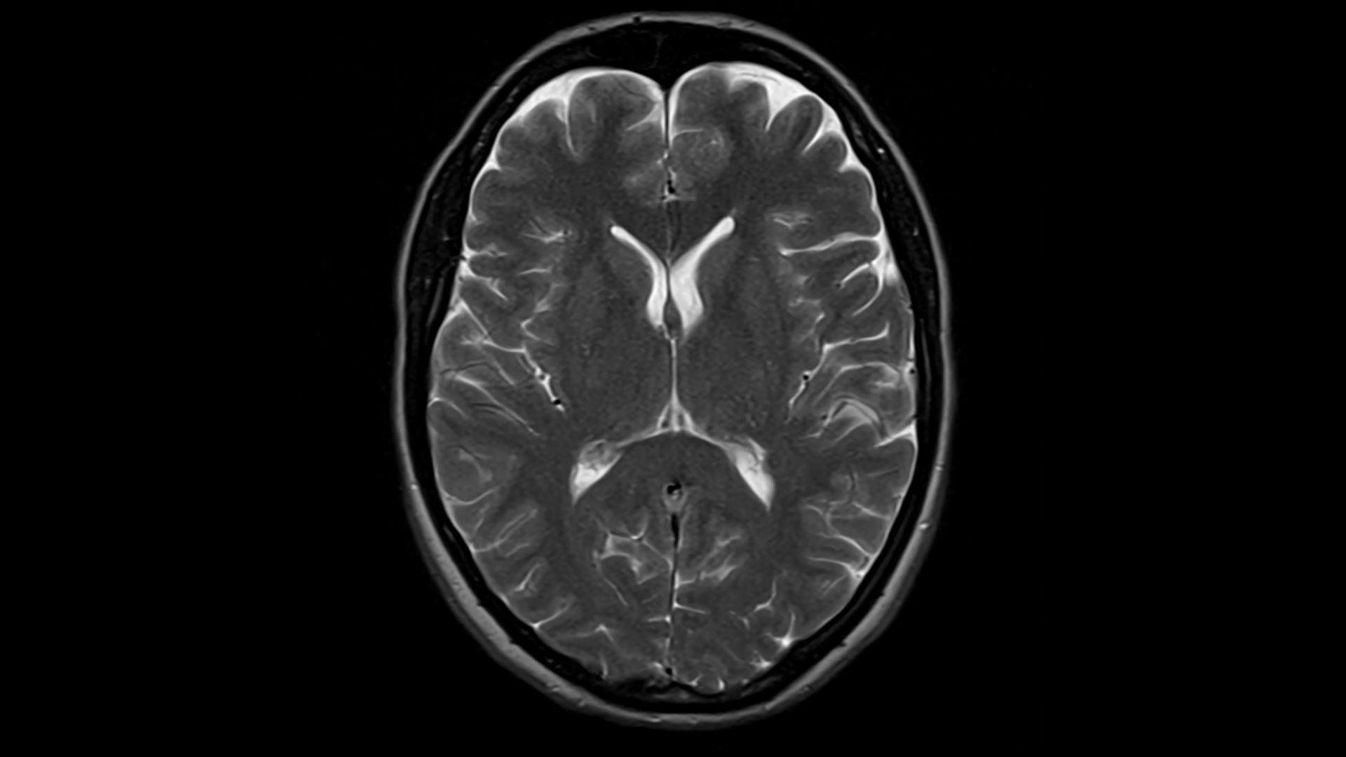 MAGNETOM Free.Max – MRT mit größerer Öffnung – Siemens Healthineers ...