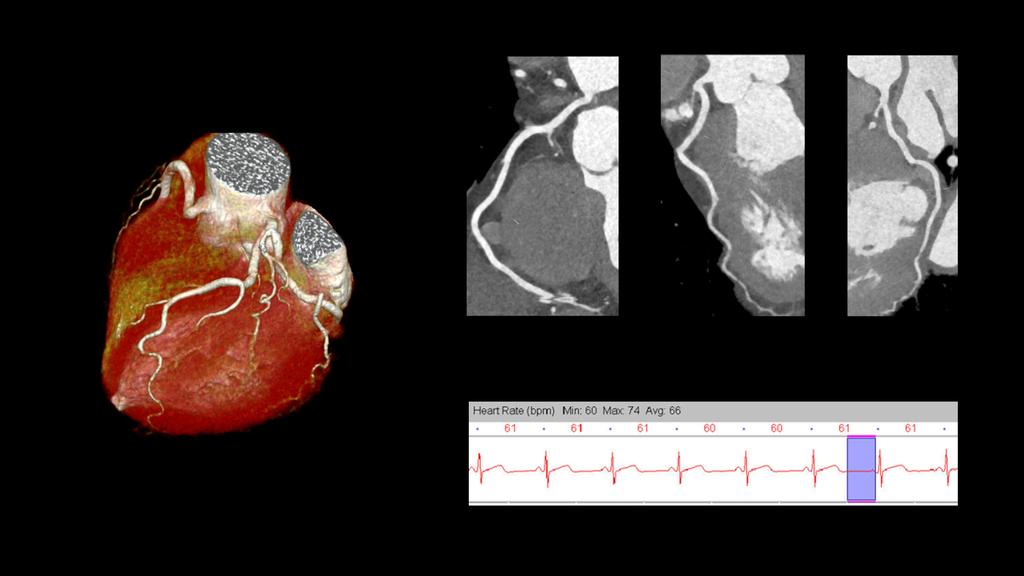 SOMATOM Drive - Siemens Healthineers USA