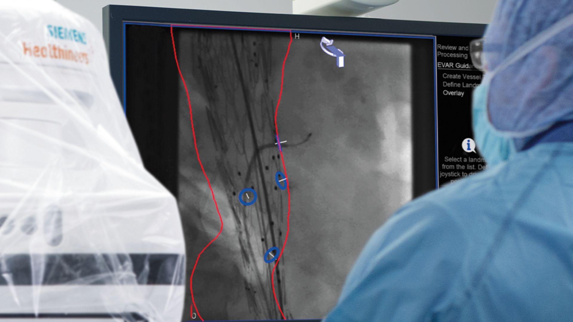 Endovascular aortic procedures and peripheral artery disease - Siemens ...
