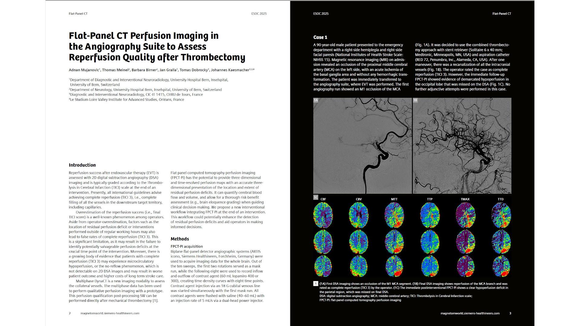 The Role of Imaging Along the Stroke Pathway
