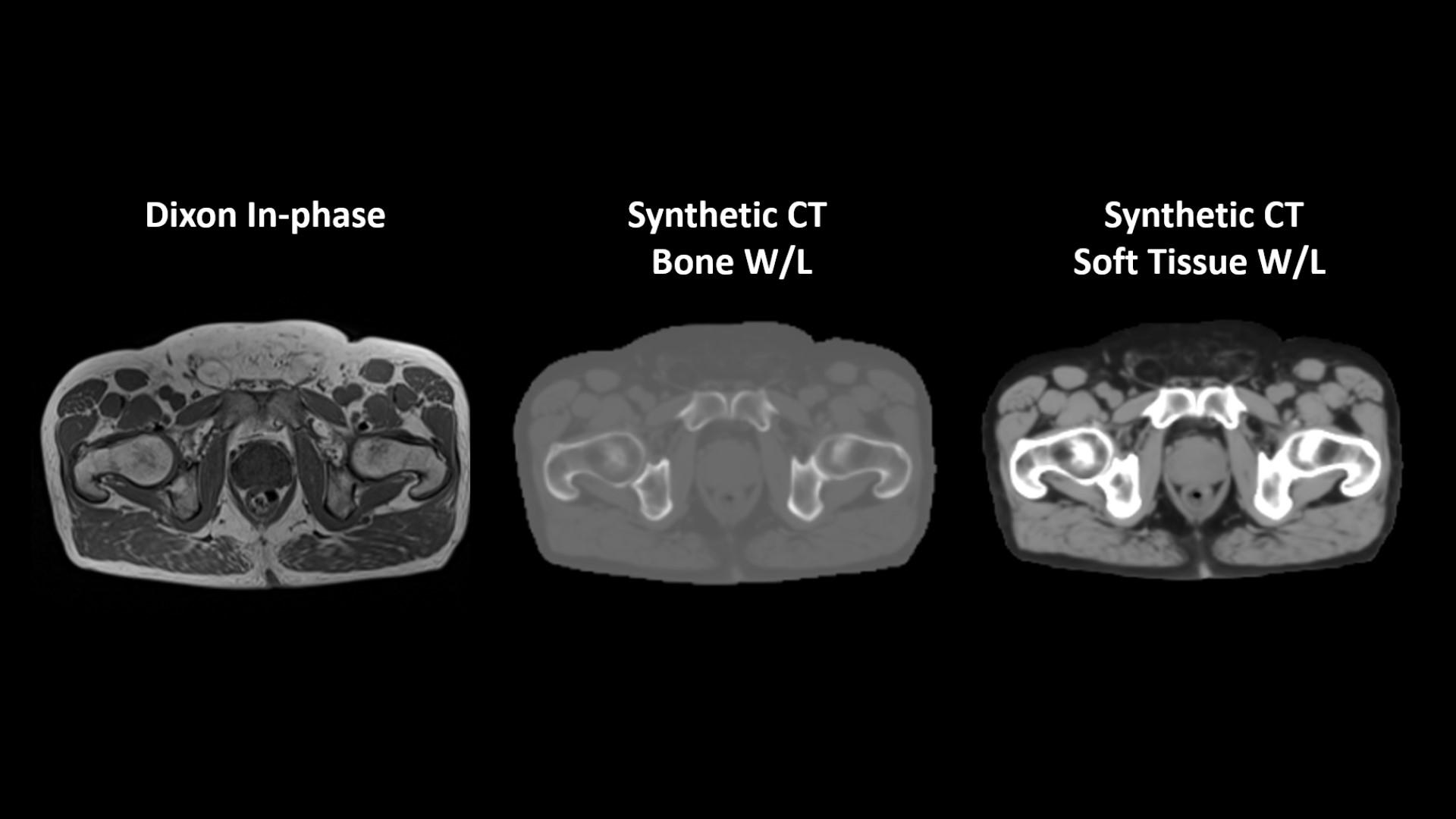 MAGNETOM Flow RT Pro Edition - Siemens Healthineers