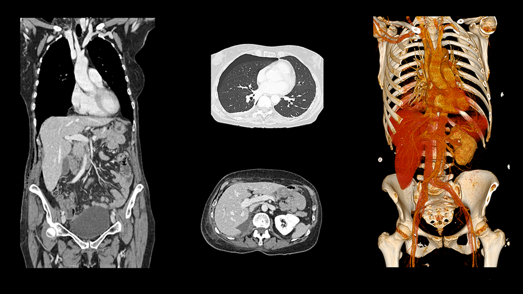 Produit de contraste - Siemens Healthineers France