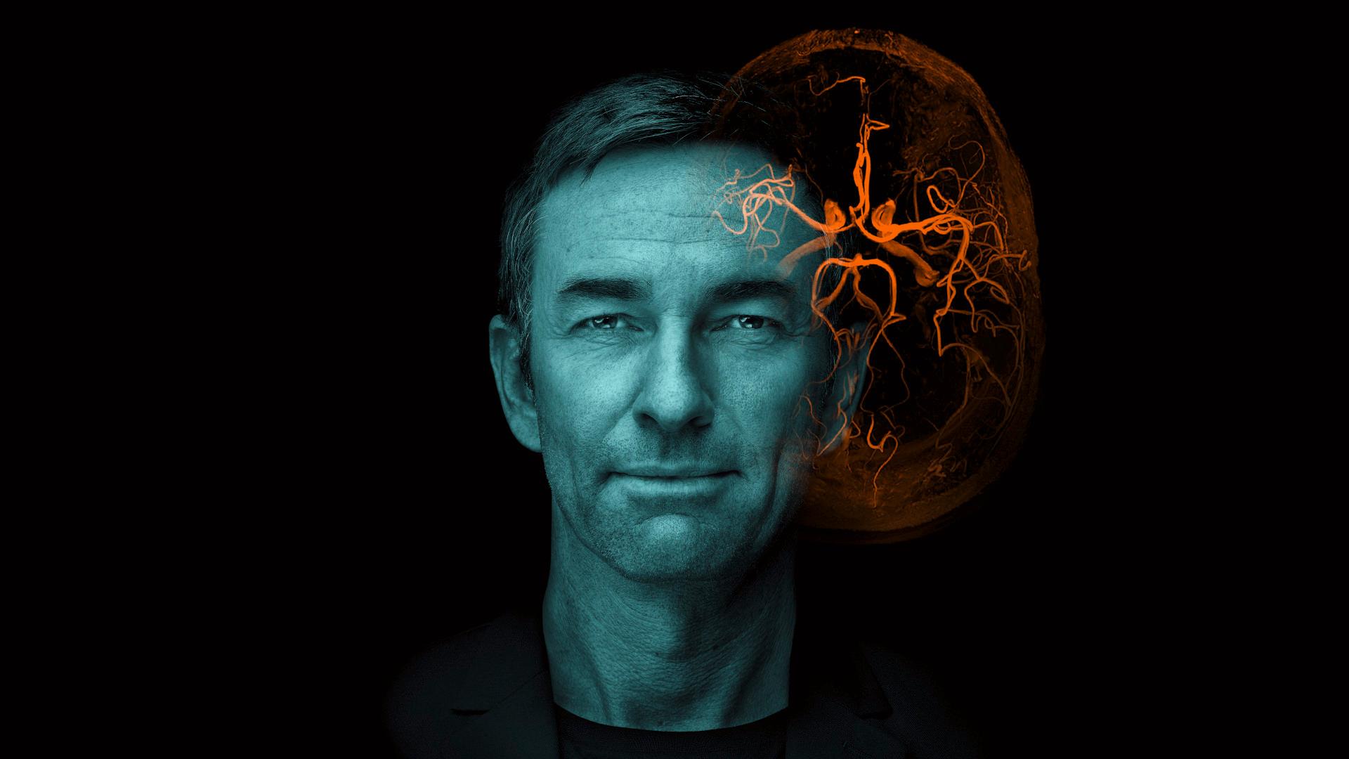 ARTIS icono – Angiography System - Siemens Healthineers